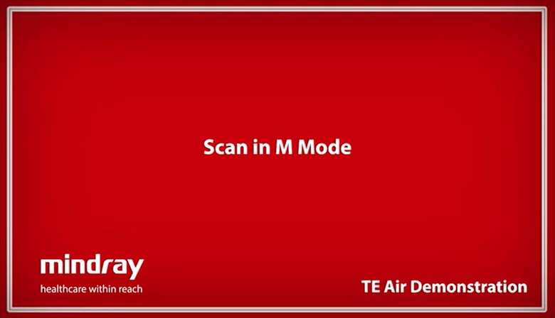 Product Tutorial Videos and Brochures of Mindray TE Air – Mindray UK ...